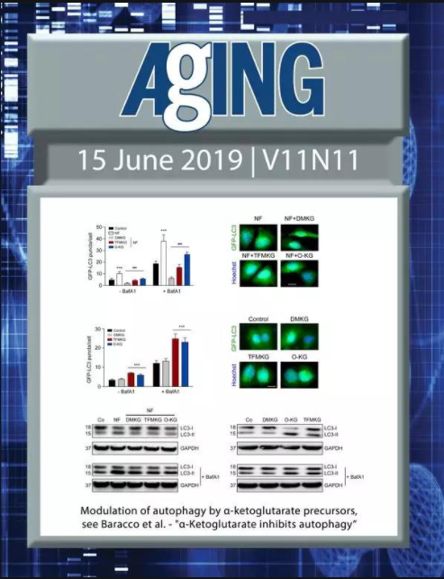 AGING-US-常笑医学网