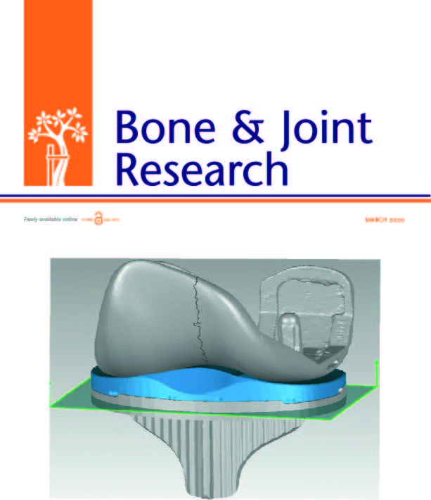 BONE & JOINT RESEARCH-常笑医学网
